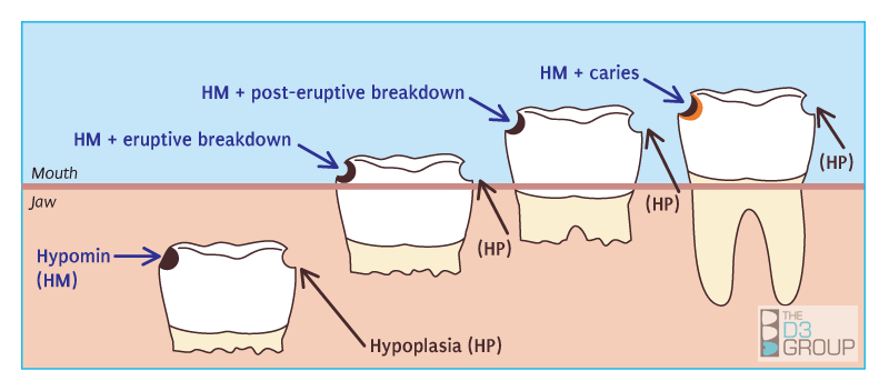HPvsHMfig-copyright-TheD3Group